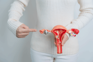 Why and How Does Obesity Increase Fibroid Prevalence? - The London ...